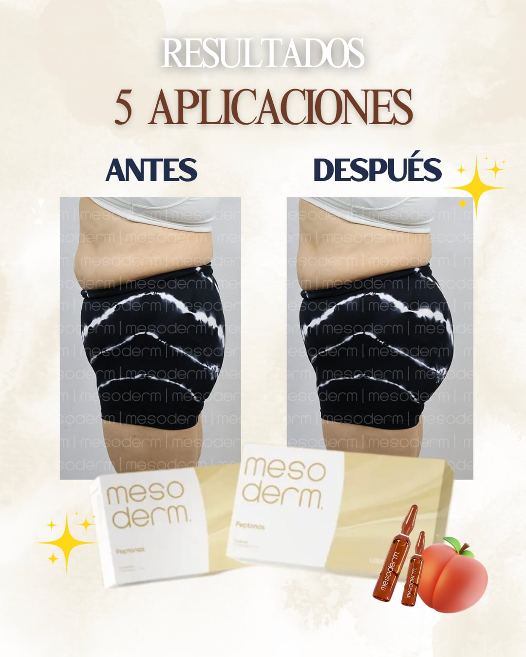 Peptonas 30 Ámpulas - Meso10 México